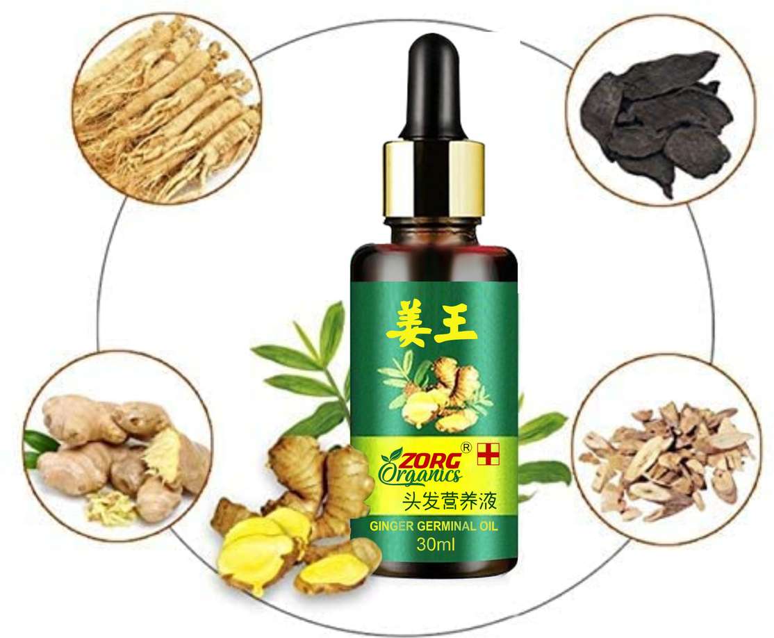 Zorg Organics Ginger Hair Oil - for Dandruff Care - All Hair Types ...
