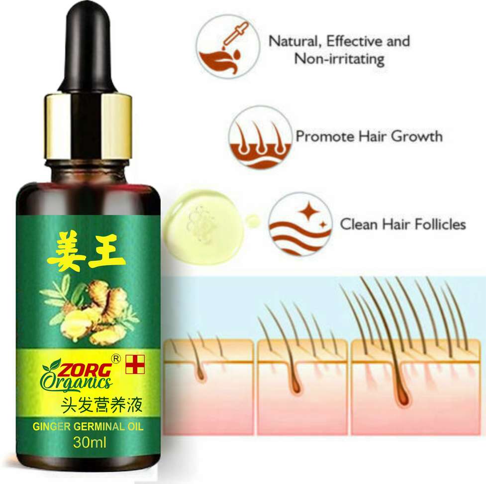 Zorg Organics Ginger Hair Oil - for Dandruff Care - All Hair Types ...