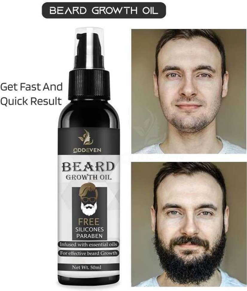 VITRACOS Most trending Beard Growth Oil For MenBeard & Dadhi Growth ...