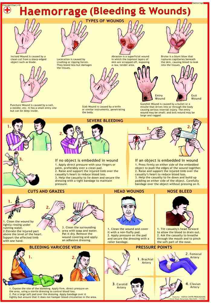 First Aid Bleeding And Wounds